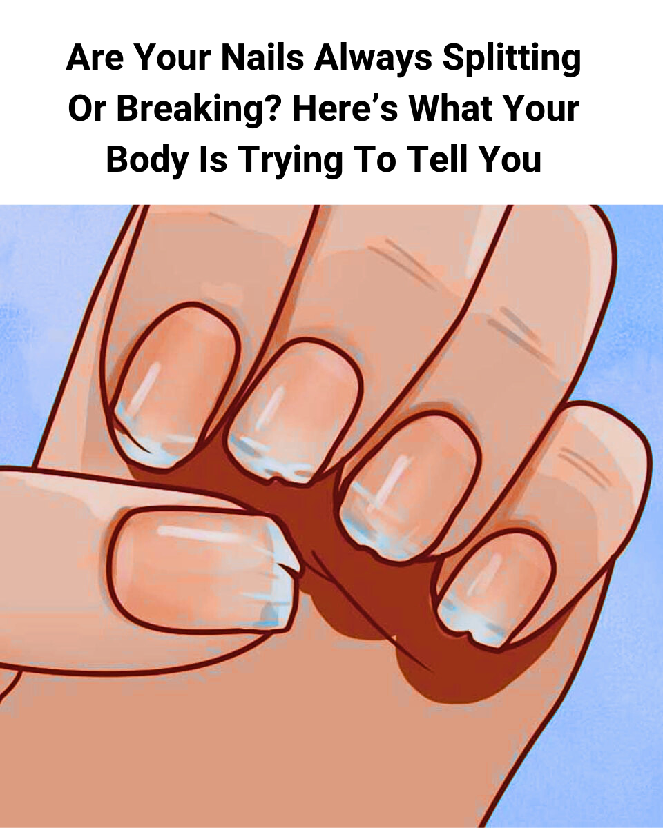 Are Your Nails Always Splitting Or Breaking? Here’s What Your Body Is ... Are Your Nails Always Splitting Or Breaking? Here’s What Your Body Is ...
